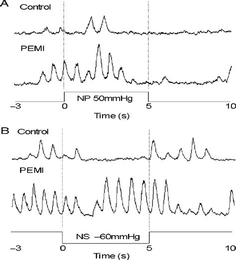 Baroreflex And Muscle Metaboreflex Control Of Muscle Sympat