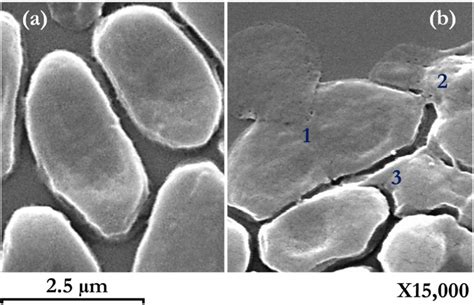 Scanning Electron Microscopy Of E Coli Nontreated A And Ozonetreated