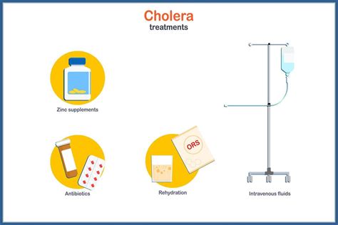 Médico Ilustración Concepto En Plano Estilo De Cólera Tratamiento Para