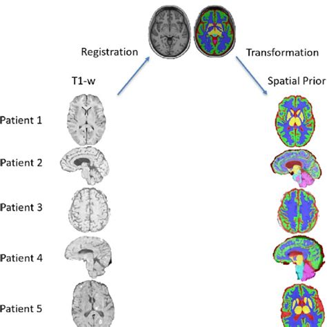 example multiclass tissue segmentation in the internal test set a