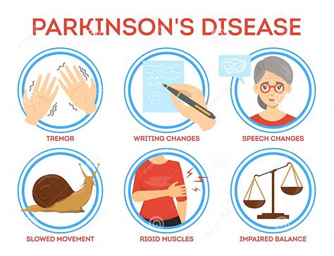 Data Analysis And Prediction Of Neurodegenerative Diseases Parkinson