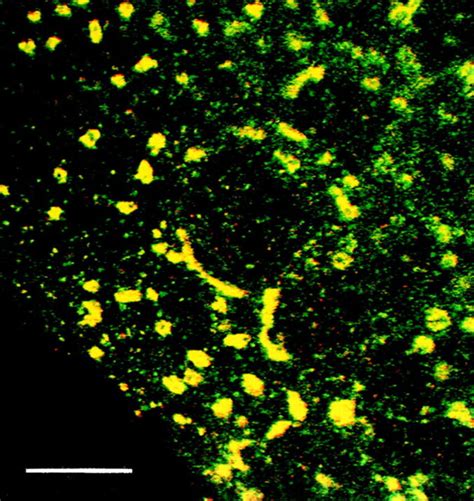 Localization Of The Vsv Tso45 G Protein During A 15°c Block Infected Download Scientific