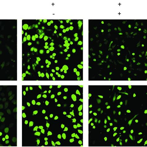 Nam Attenuated Bev Induced Oxidative Stress In Arpe 19 Cells Bev