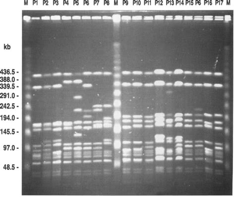 Examples Of Pfge Patterns Obtained Following Digestion Of N