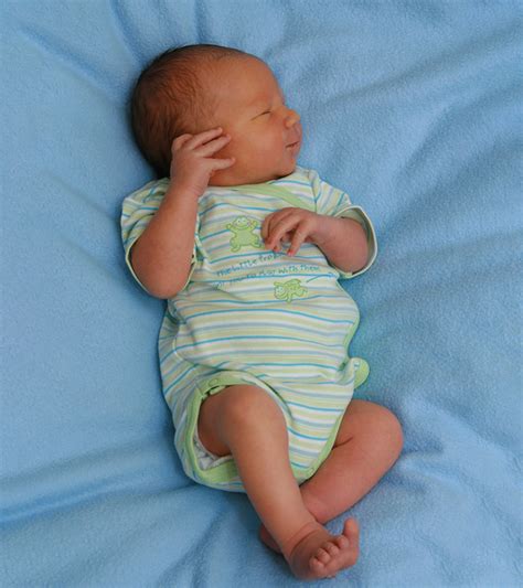 Neonatal Jaundice Babies
