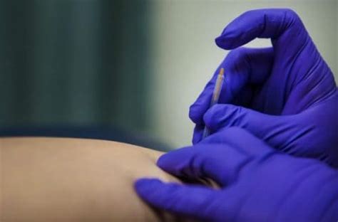 Dry Needling For Plantar Fasciitis And Electro Stimulation Explained