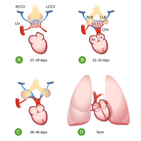 Total Anomalous Pulmonary Venous Return Tapvr Concise Medical Knowledge