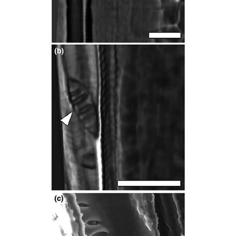 Steeply Angled Vitis Vinifera Scalariform Perforation Plates Were