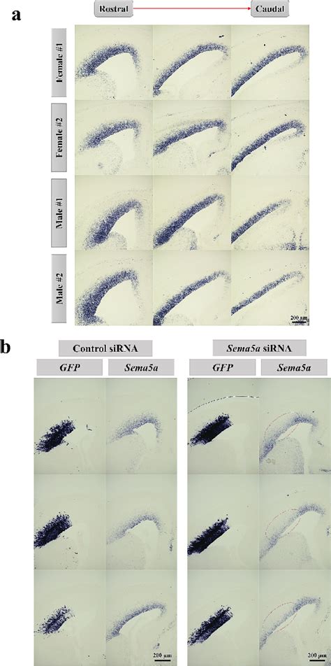 In Situ Hybridization Ish Analyses Using E145 Embryonic Mouse Brain