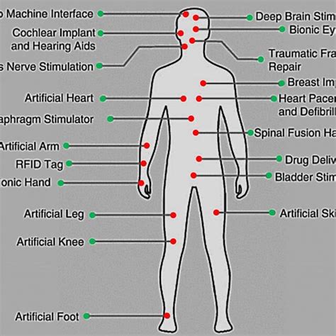 Diverse Body Locations Of Implanted Devices Download Scientific Diagram