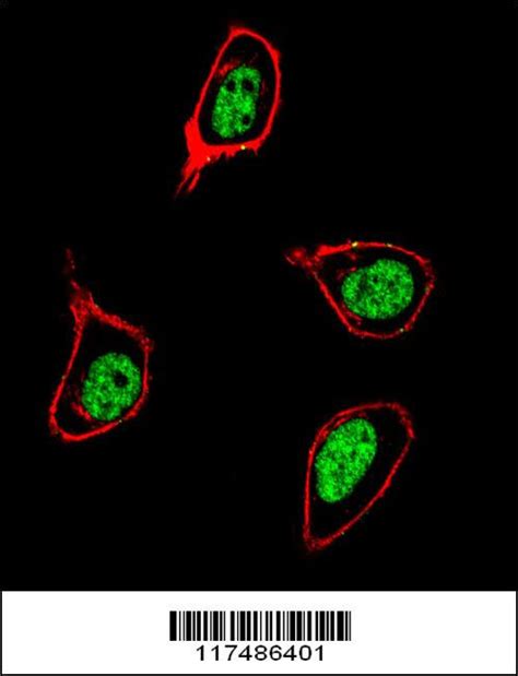 Pcna Antibody C Term Purified Rabbit Polyclonal Antibody Pab Ihc