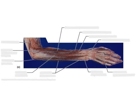 Gross Anatomy Forearm Cad Quiz