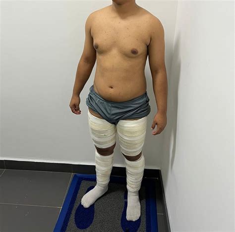 Jovem é Preso Em Aeroporto De Sc Com 3 Kg De Cocaína Escondidos Junto