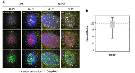 Deepfoci Deep Learning Based Algorithm For Fast Automatic Analysis Of