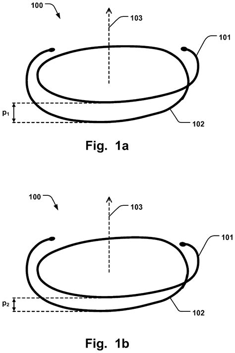 Annuloplasty Device Eureka Patsnap
