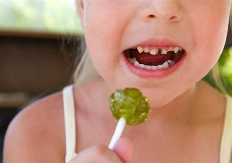 Why Are My Teeth Rotting And Breaking Off Causes And Treatments