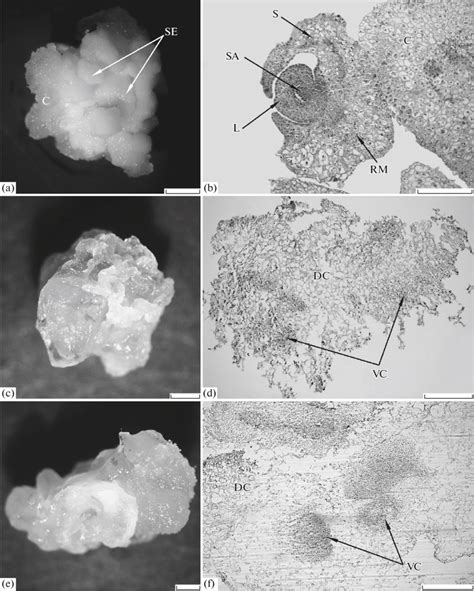 Embryogenic And Nonembryogenic Wheat Calli 2 Week Cultivation In Vitro