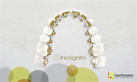 Incognito™ Braces What Can We Do To Make You Smile