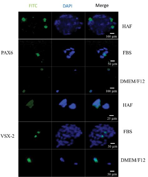 Immunostaining For Pax6 And Vsx2 Markers Pax6 Nuclear Expression And