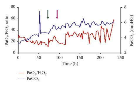 Hemodynamic Parameters Map And Pulse And Respiratory Profiles