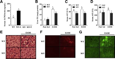 Global Ablation Of Lipocaline 2 Lcn2 Partially Alleviates Alcoholic