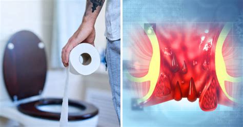 Immediate Constipation Relief At Home ना औषध ना पथ्यपाणी फक्त या