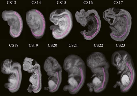 Human Embryo Tail