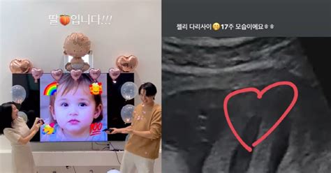이지훈♥아야네 임신 17주 초음파 공개→성별은 확답은 32주부터
