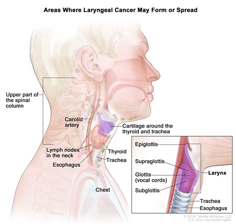 Definition Of Laryngeal Nci Dictionary Of Cancer Terms Nci