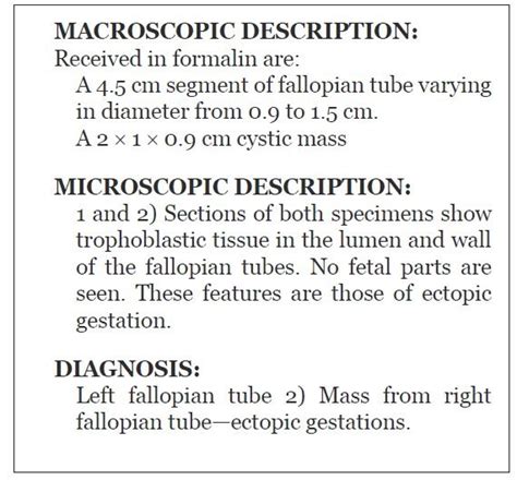 Spontaneous Bilateral Tubal Ectopic Pregnancy A Case Report Journal