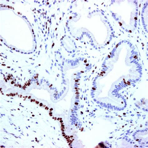 After The Reconstruction Hepaticojejunostomy Is Mirrored Download