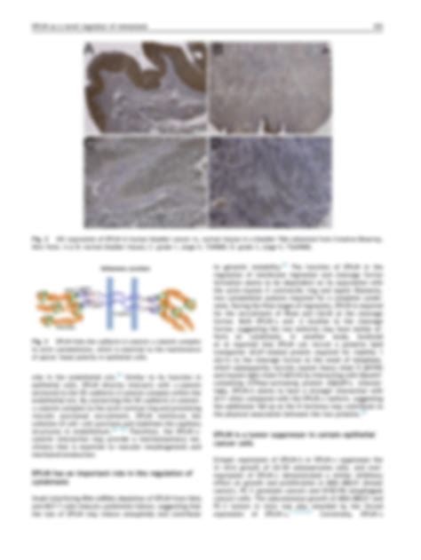 Solution Epithelial Protein Lost In Neoplasm Eplin Beyond A Tumor
