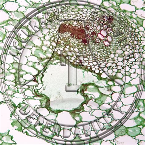 Cabbage Black Rot Prepared Microscope Slide