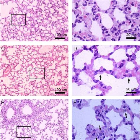 Histopathological Pictures Of The Lungs From Mice Intratracheally