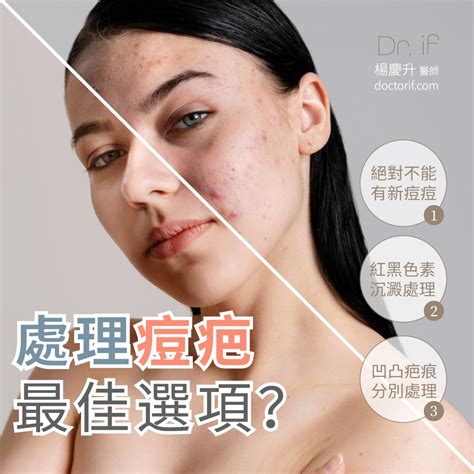 醫膚親子皮膚專科診所 長 痘痘 幾乎是每個人必經的人生大事 「 痘疤