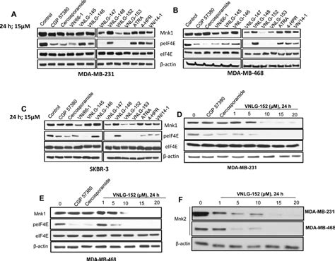 Rrs Reduce Mnk Expression And Eif4e Phosphorylation In Breast Cancer