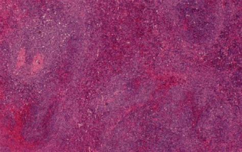 Low Power Magnification Of The Splenic Tissue This Slide Displays
