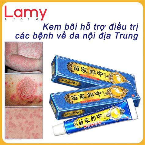 Kem Xanh Bôi Nấm Ngứa Vảy Nến Chàm Tổ Đỉa Lang Ben Nấm Da Đầu