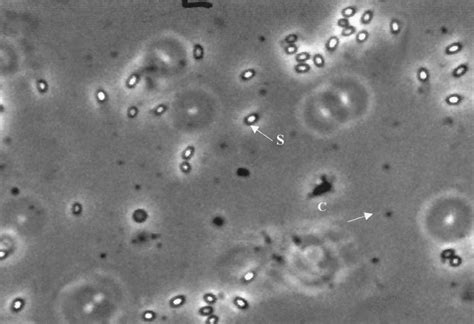 Light Micrograph Of Bacillus Thuringiensis Subsp Israelensis Bti