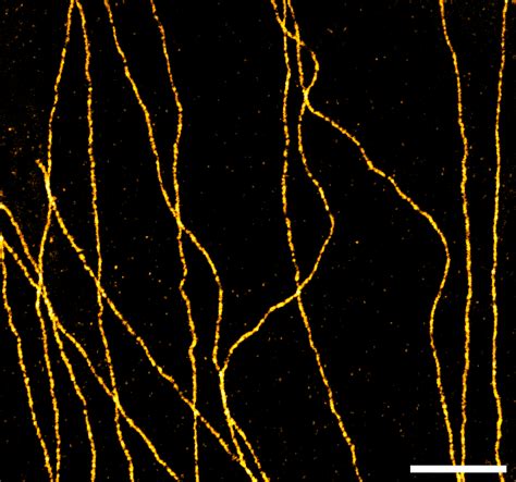 Super Resolution Microscopy Principles Technologies And Considerations For Reagent Selection
