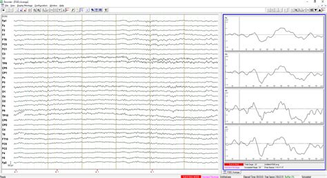 Brainvision Recorder Brain Products Gmbh Solutions