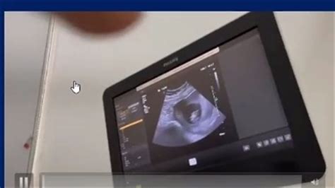 تشخیص جنسیت جنین از روی عکس و فیلم های ارسالی شما نماشا