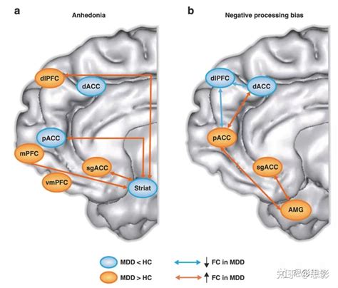 前额叶皮层和抑郁 知乎