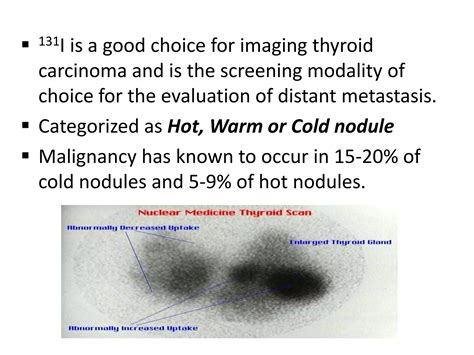 Investigations Thyroid Carcinoma Pptx