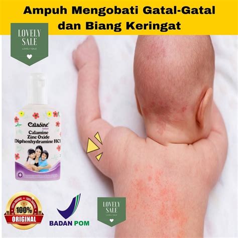Jual Caladine Lotion Calamine Zinc Oxide Diphenhydramine Hci 60ml Obat
