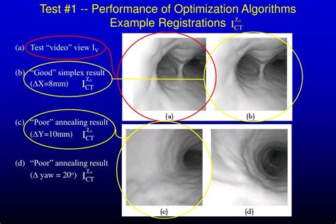 Ppt Ct Video Registration Accuracy For Virtual Guidance Of