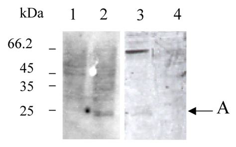 Expression And Display Of Abp1 In Sf9 Cells Infected By The Cdna