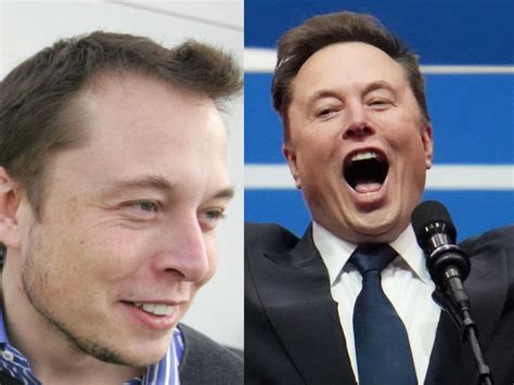 🚀 Elon Musks Zähnen Eine Milliardenschwere Reise Lema Dental Clinic