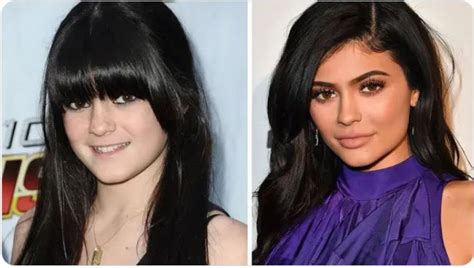 Ovako Je Kylie Jenner Izgledala Prije Svih Operacija