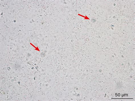 Toxoplasma Gondii Egg